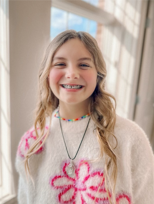 Damon Ultima Braces | Walker Dixon Ortho